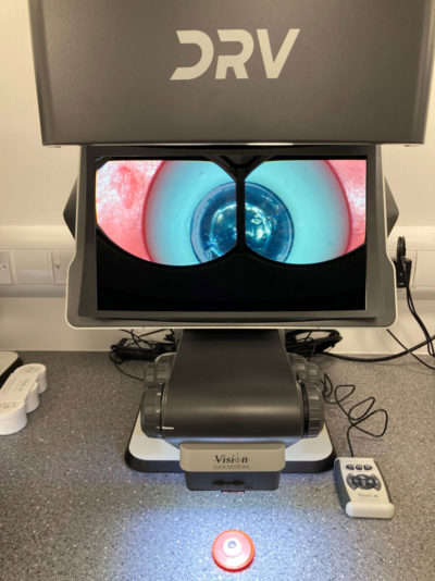 Ophthalmology & ENT - Vision TriTeQ